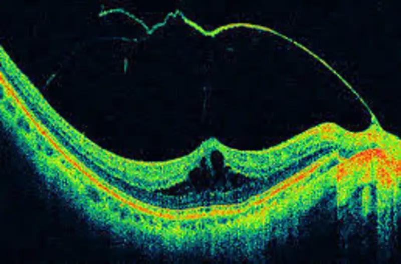 Optometrist in North Galt, Cambridge | G&G Eye Doctors